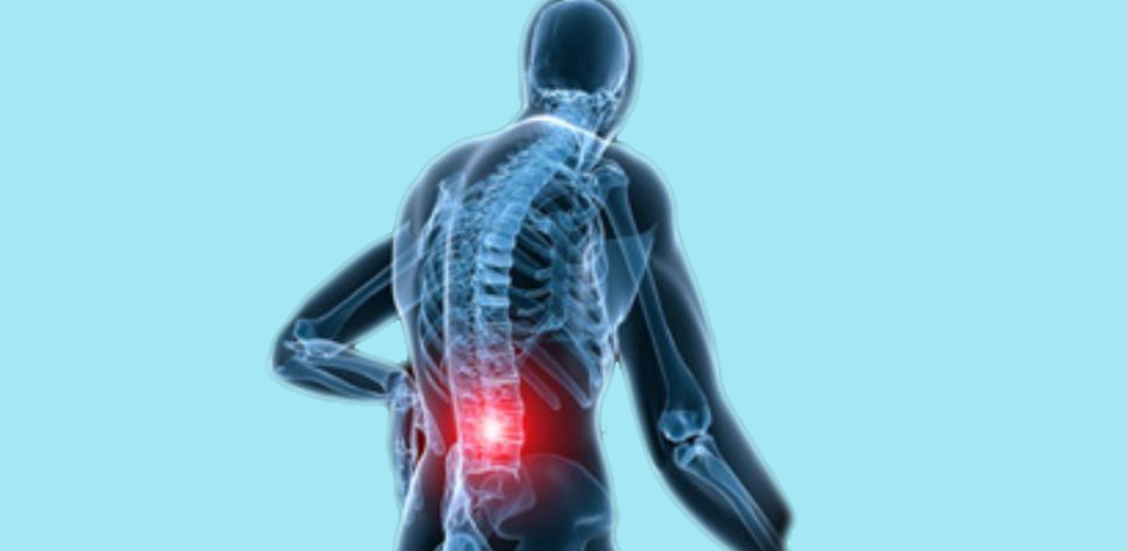 Spine Care Physiotherapy – Spine Clinic | Ortho Neuro Physiotherapy Clinic